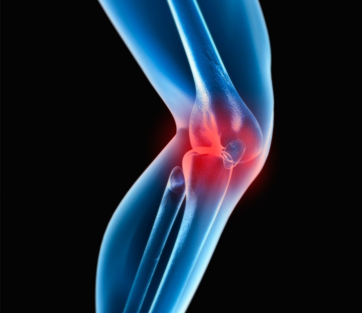 Knee cracking store